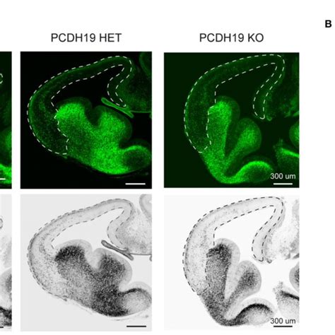 Figure Cortical Interneuron Migration Upon Loss Of Pcdhhh In Vivo A Download Scientific
