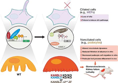 Nsl Complex Mediated Regulation Of Ift Genes Exhibits A Bifurcation Of