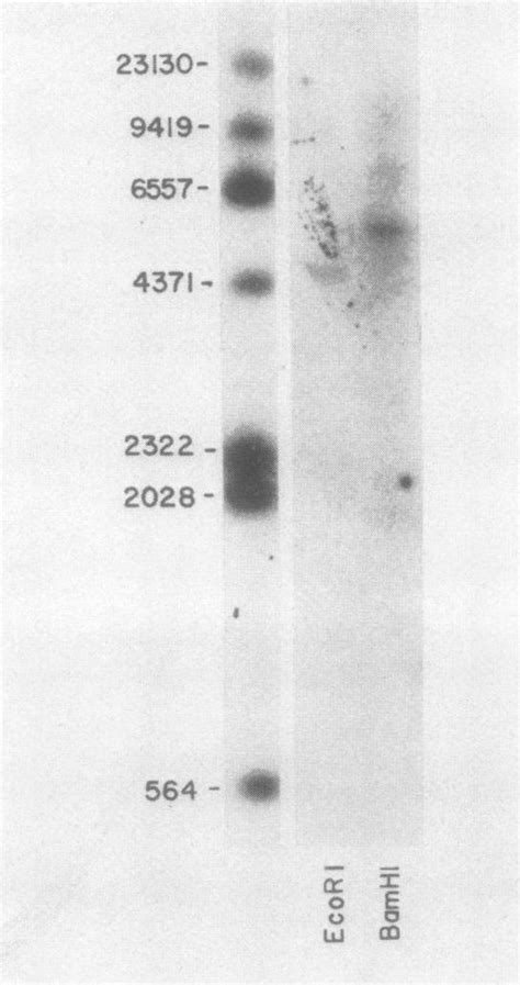 35s Methionine Labeled Cell Free Reticulocyte System Translation