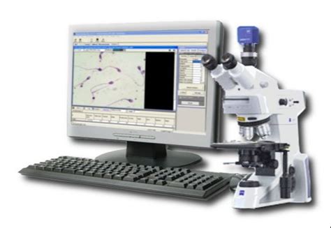 Automated Semen Analyser Automated Sperm Analyzer Latest Price