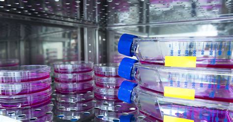 Why Medical Lab Techs Rely On Real Time Incubator Temperature Monitoring