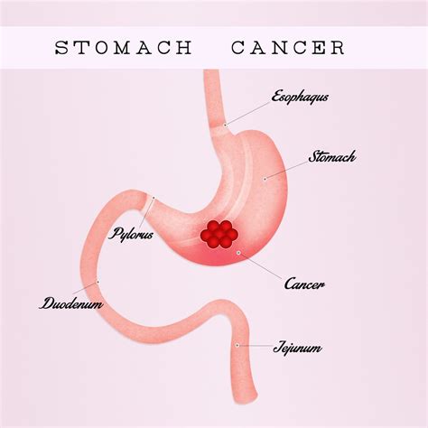 Duodeno Características concepto e histología