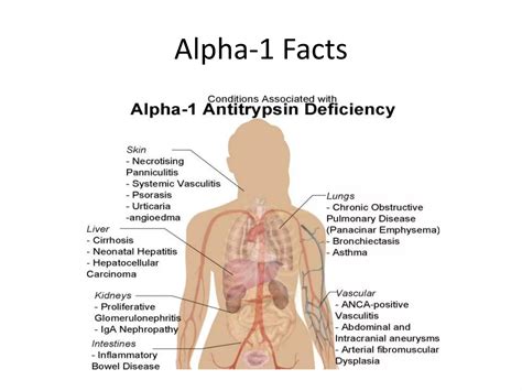 Alpha 1 Antitrypsin Deficiency Pptx