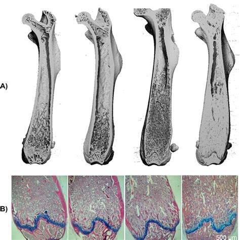 Osteocyte‐specific Degradation‐resistant Hif‐2α Accumulation Generates