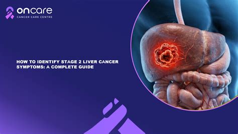 Stage 2 Cervical Cancer Treatment And Recovery Oncare Hospital