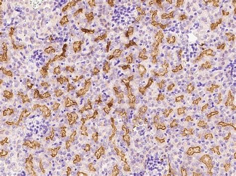 Sino Biological Ephb2eph Receptor B2 Antibody Rabbit Pab Antigen