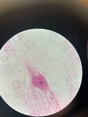 Nervous System Special Senses Flashcards Quizlet
