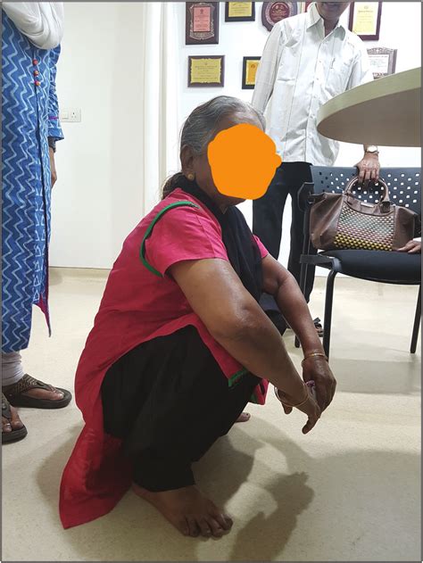 Postoperative 1 Month The Patient Was Able To Perform Squatting