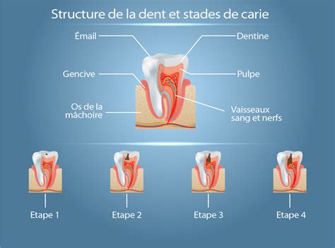 Douleurs dentaires causes symptômes et traitements