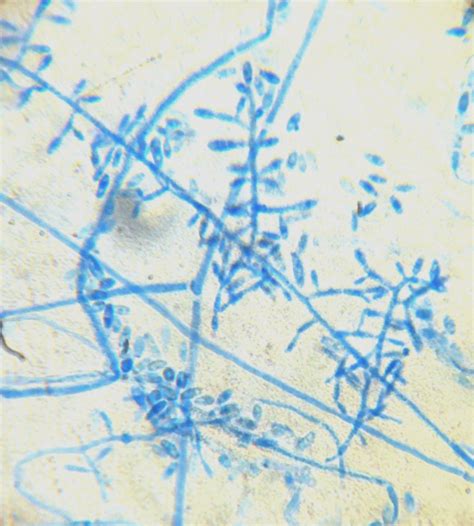Can Anyone Help Me Identify These Four Microscopic Photographs Of Fungi