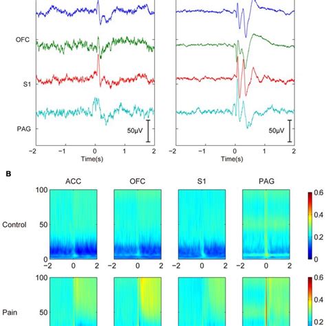 Trial Averaged Local Field Potentials Lfps Show Persistent Power