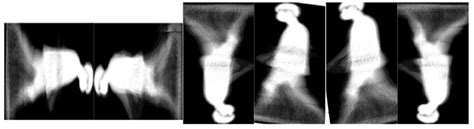 a deep learning approach for identifying a drunk person using gait recognition