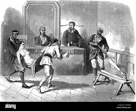 Corporal Punishment By Guillotine Amputation Of A Foot Or Leg In C19th China Peking Or Beijing