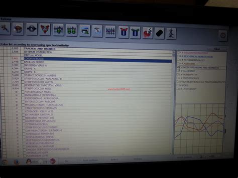 Metatron Nls 25d Nls Bioresonance Health Analyzer 5