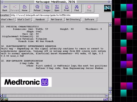 Pacemaker Radiologyanintroduction Ppt