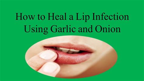 Can You Use Antibiotic Cream On Lips