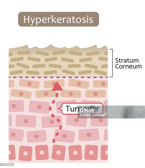 Stratum Corneum Diagram