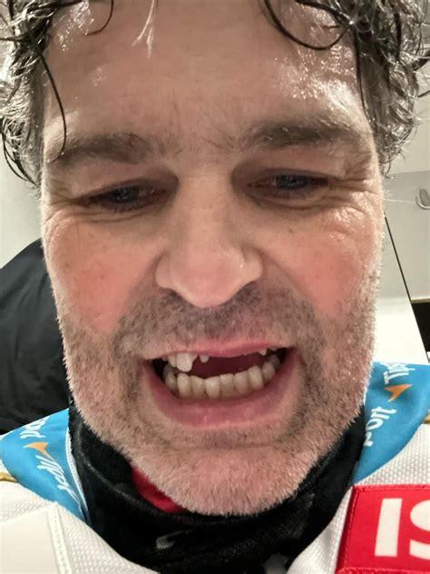 Hockey Player Jaromir Jagr Shows Four Missing Front Teeth