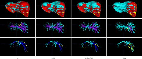 Comparison Of Liver Segmentation Performance With Different Model