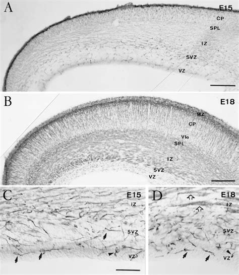 Figure 3 From Developmental History Of The Subplate And Developing White Matter In The Murine