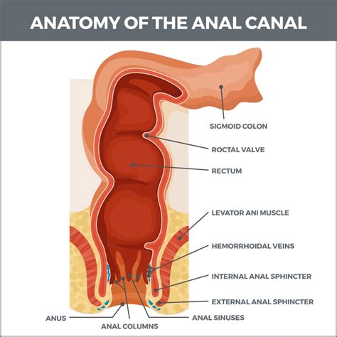Understanding Bowel Incontinence Ask The Nurse Expert