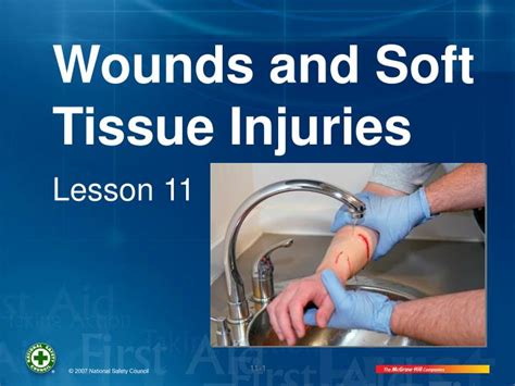Ppt Wounds And Soft Tissue Injuries Powerpoint Presentation Free