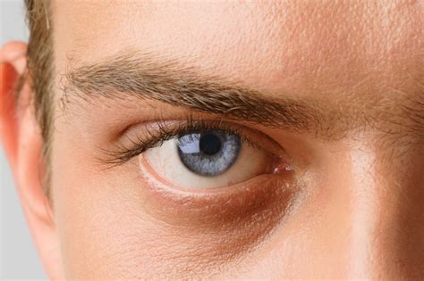 Ocular Larva Migrans Causes Side Effects And Treatments At