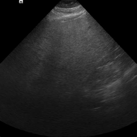 Example Image For Which All 9 Radiologists Assigned Visualization C A Download Scientific