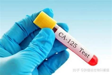 糖类抗原 125的临床应用 知乎
