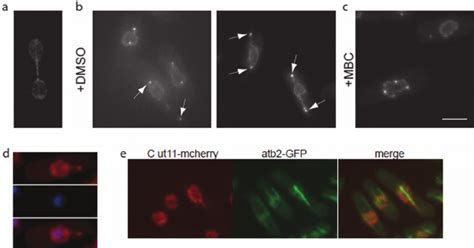 Loss Of Kinetochorespb Interactions Result In Tether Formation During