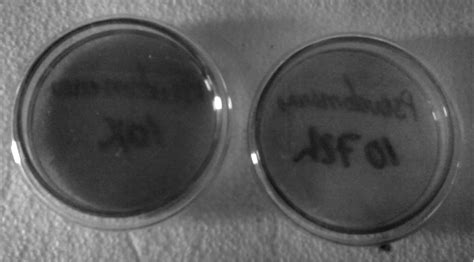 The Presence Of The Phenazine Of Pyocyanin In Control Colonies Of
