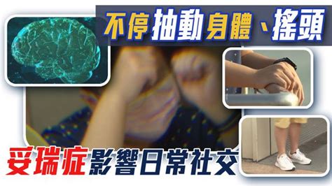 【醫療室】不停抽動身體、搖頭 妥瑞症影響日常社交 醫療 無綫新聞tvb News