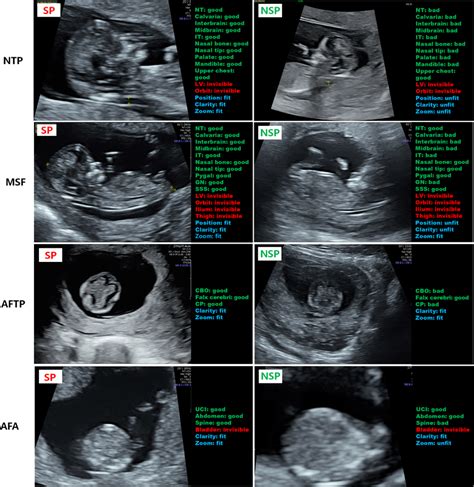 Examples Of Standard And Nonstandard Images And The Reasons Manually