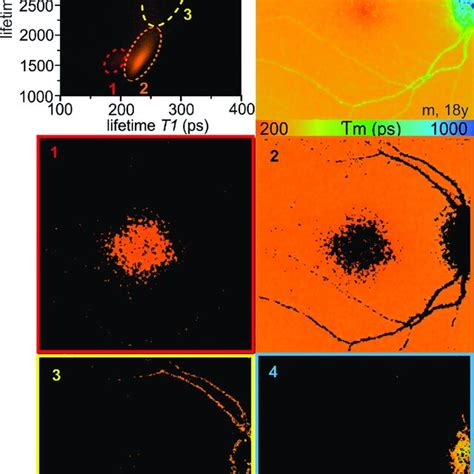 Scatter Plot Of Fluorescence Lifetime Parameters The Scatter Plot