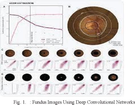 Figure 1 From Automated Detection Of Glaucoma From Fundus Images Using Deep Convolutional