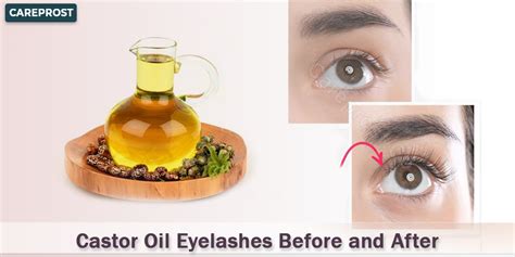 Castor Oil Eyelashes Before And After Unveiling The Secrets Of Natural