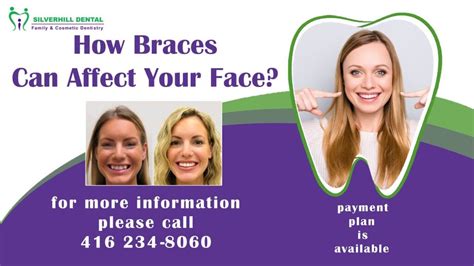 Effect Of Orthodontics On Beauty 1 Dentist In Etobicoke