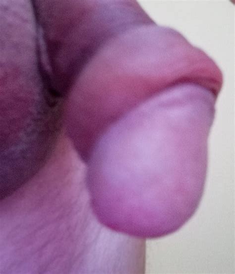 Me Dick Pitsi