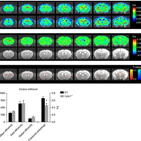Cyfip1− Mice Show Defects In Callosal Architecture A Diffusion Download Scientific Diagram