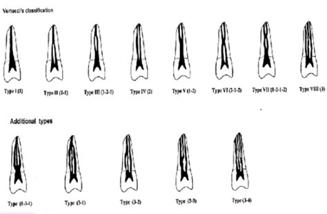 L2 Root Canal Configuration And Access Cavity Preperation Anterior