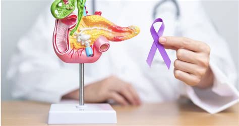 Tumore Al Pancreas Quali Sono Le Aspettative Di Vita