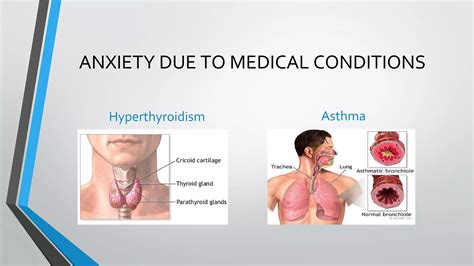 Anxiety Disorders Dsm 5 Ppt