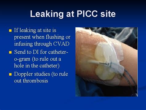 Peripherally Inserted Central Catheter PICC Trouble Shooting Chantal