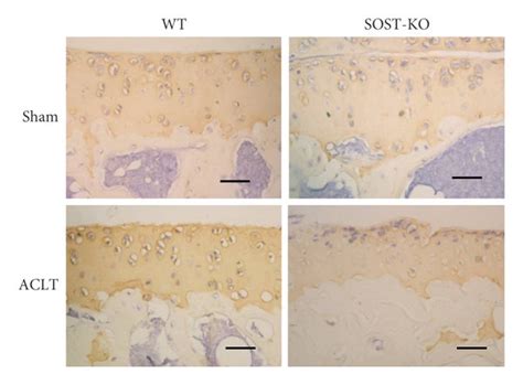 After Aclt Sost Ko Mice Presented With A Severer Oa Phenotype When