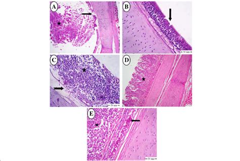 A Histopathological Examination Of The Trachea From Chicken In Group I