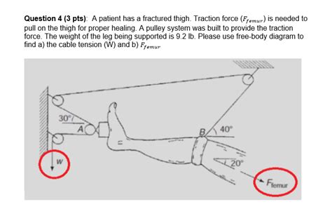 Question Pts A Patient Has A Fractured Thigh Chegg
