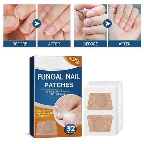 Toenail Fungus Treatment24 Hour Nighttime Renewal Fungal Nail Patches