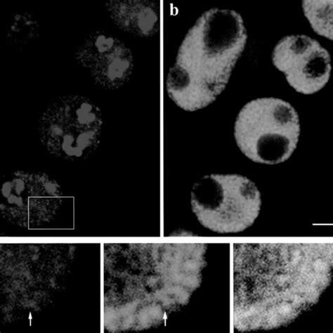 Double Labeling Of The Wheat 1a1r Translocation Line In Which One Arm