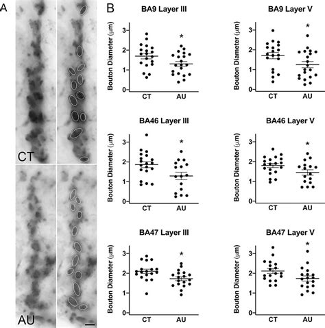 A Ch Cell Cartridges Stained With Pv In Control And Asd Prefrontal Download Scientific Diagram