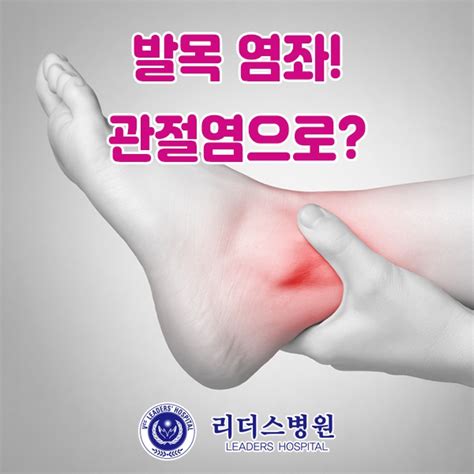 리더스병원 발목 염좌 관절염으로 발목염좌 발목에서 흔하게 발생하는 손상 중